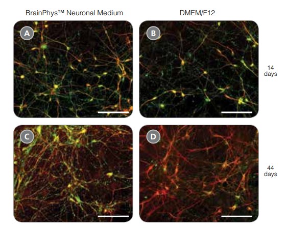 BrainPhys Neuronal Medium for Improved Neuronal Function | Axion Biosystems